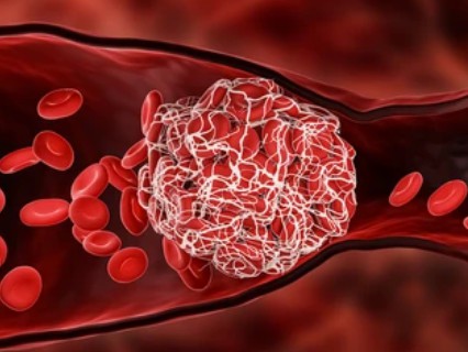 Custom Magnetic Nanoparticles for Piezoelectric Detection of Myoglobin ...